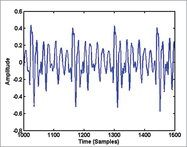 Understanding Spectrogram Of Speech Signal Using Matlab Program Smps